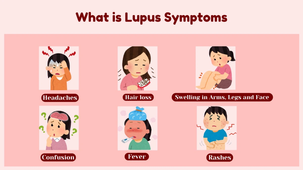 Lupus Explained: A Guide to Symptoms, Diagnosis, & Treatment